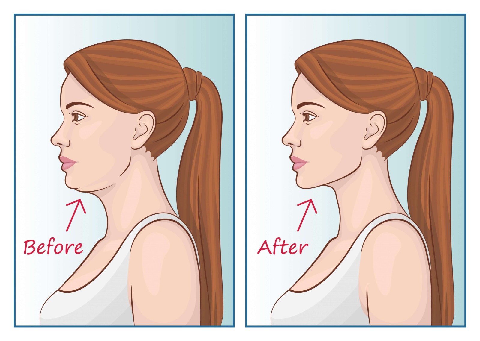 Eric Davis Dental - Mewing: What is Mewing? And Does it Work? Eric Davis Dental - Mewing: What is Mewing? And Does it Work?