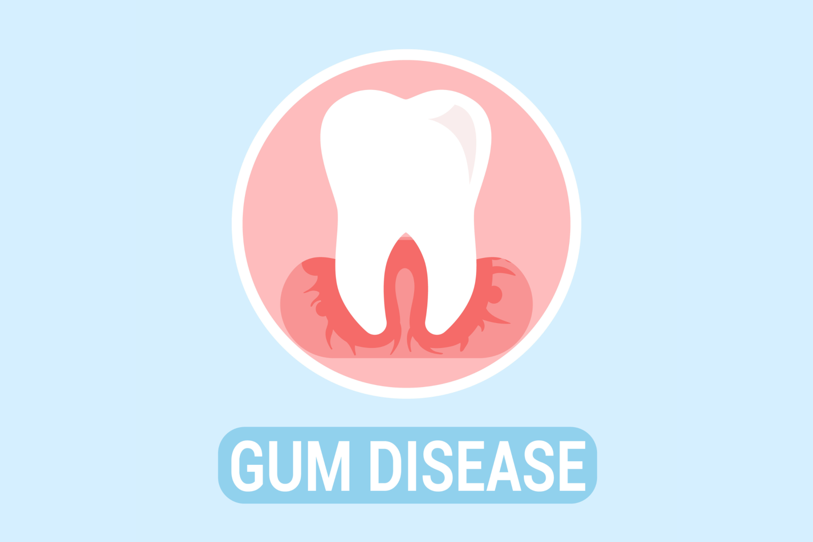 Eric Davis Dental - Periodontal Disease Treatment — A More Effective ...