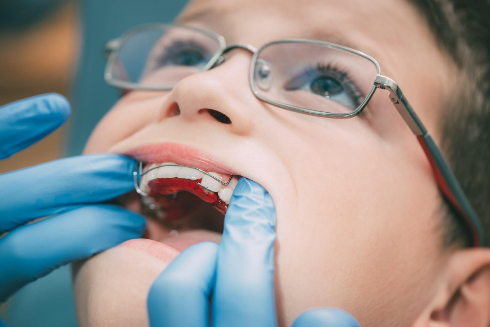 Eric Davis Dental - The Differences Between Orthotropics and Orthodontics